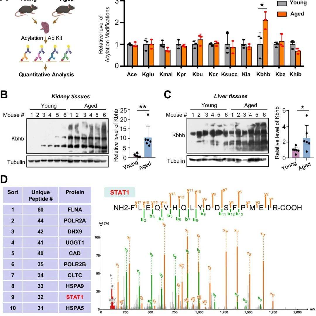 CMI丨电子科技大学郑慧团队研究阐述老年人抗病毒防御变化机制并挖掘改善药物_Kbhb_调节_O-GlcNAc