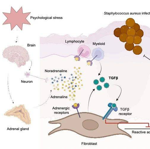 Sci Immuno丨心理应激增强细菌感染易感性的调控机制_action_stress_免疫